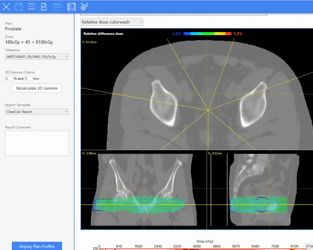 RadMonteCarlo | Radformation