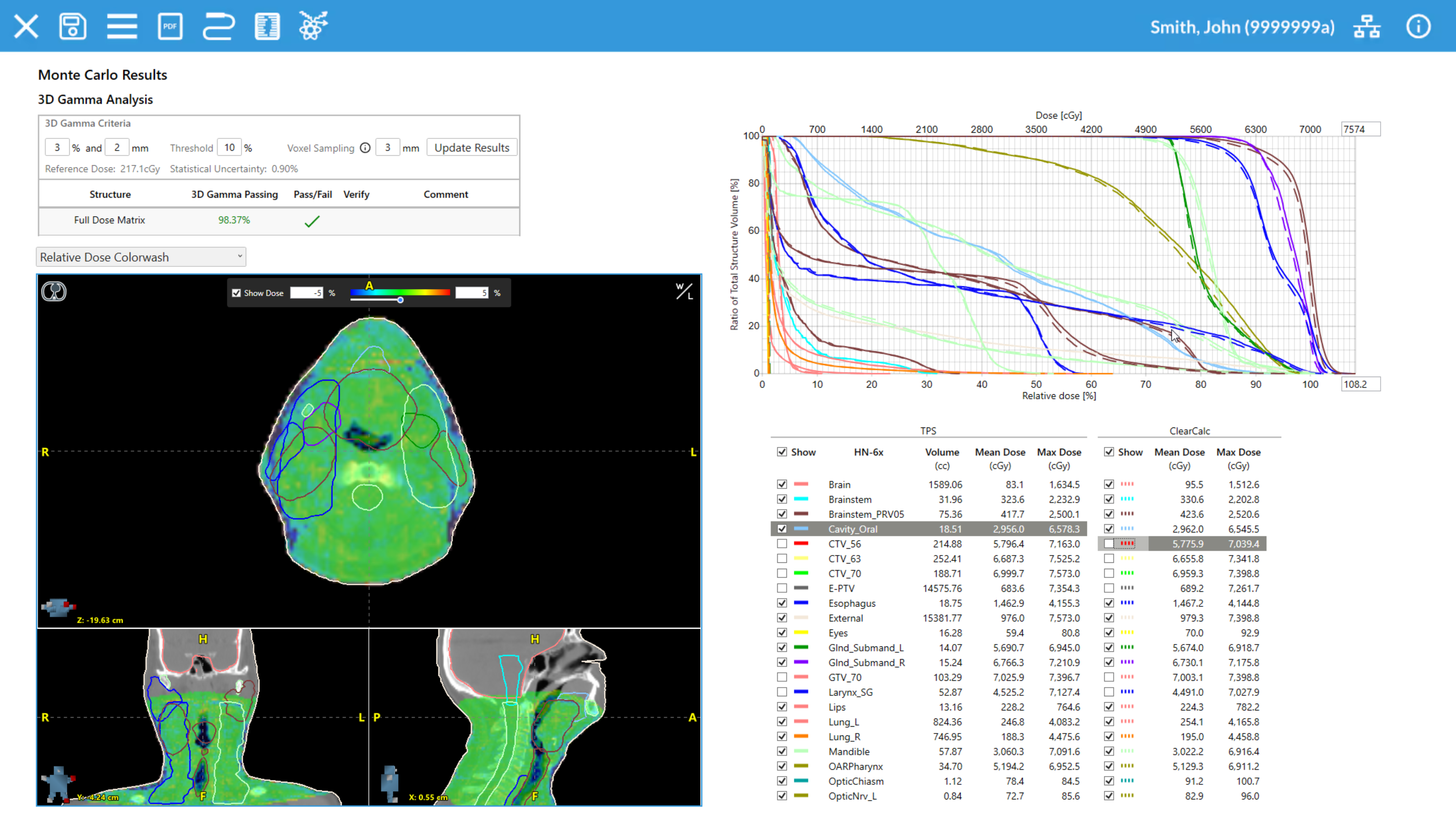 RadMonteCarlo | Radformation
