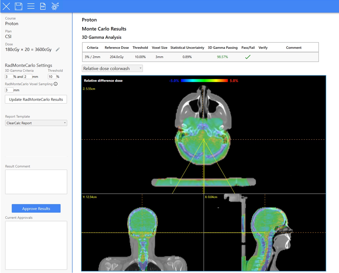 RadMonteCarlo | Radformation